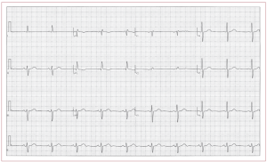 EKG Practice Test for the Nurse Practitioner and Physician Assistant
